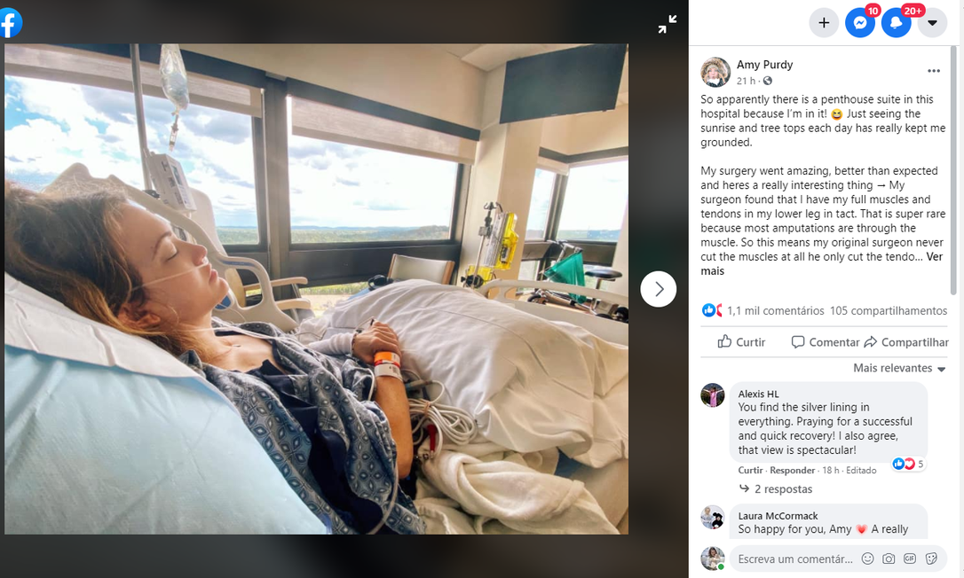 Dançarina biamputada da Paralimpíada do Rio relata cirurgia 'mais ...