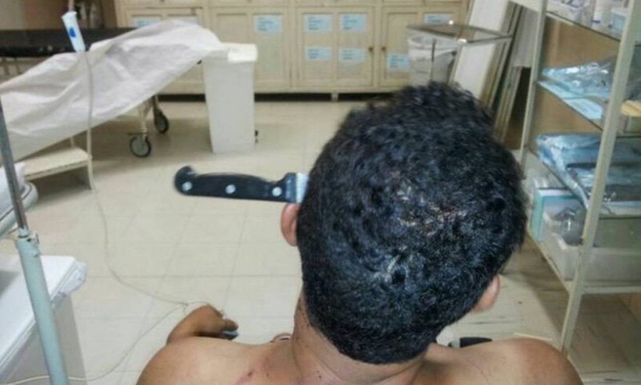 Homem sobrevive depois de levar facada na cabeça - Jornal O Globo