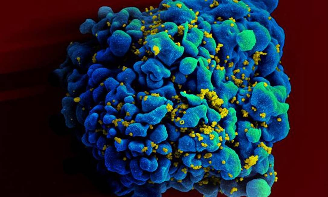 Ataque genético ao HIV - Jornal O Globo