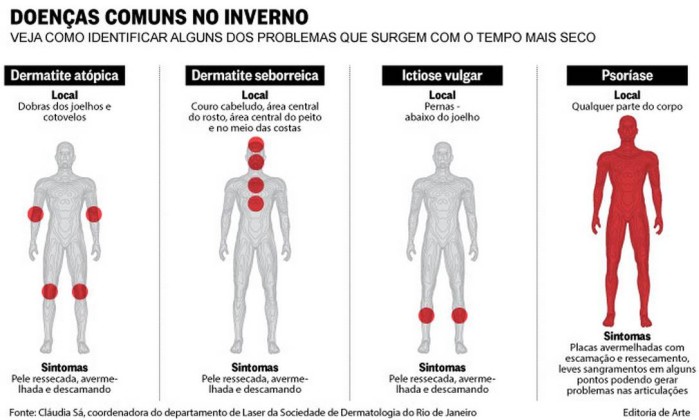 Propagação de doenças de pele aumenta no inverno; veja como evitar ...