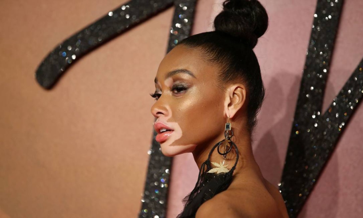 Winnie Harlow, modelo com vitiligo, arrasa em tapete vermelho repleto ...