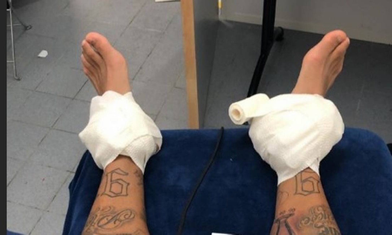 Neymar usa bolsas de gelo nos tornozelos após vitória: 'No pain, no ...