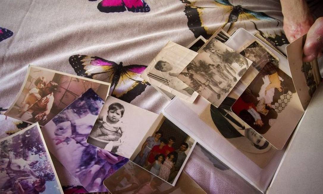 Doença de Günther: como é viver com condição devastadora que ataca ...