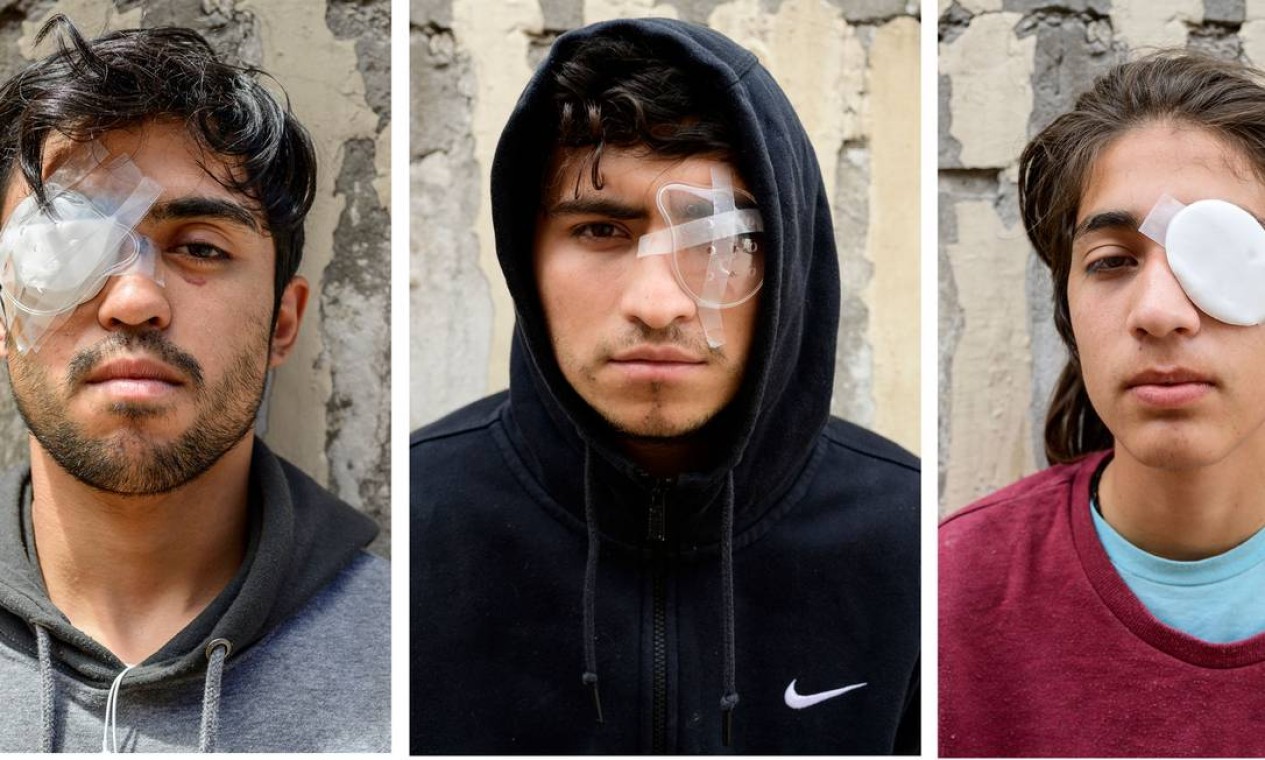 As histórias das dezenas de pessoas cegas pela polícia no Chile ...